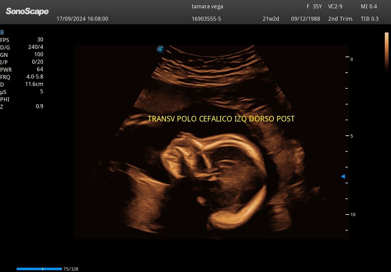 Ecografía Doppler en el embarazo: utilidad e indicaciones