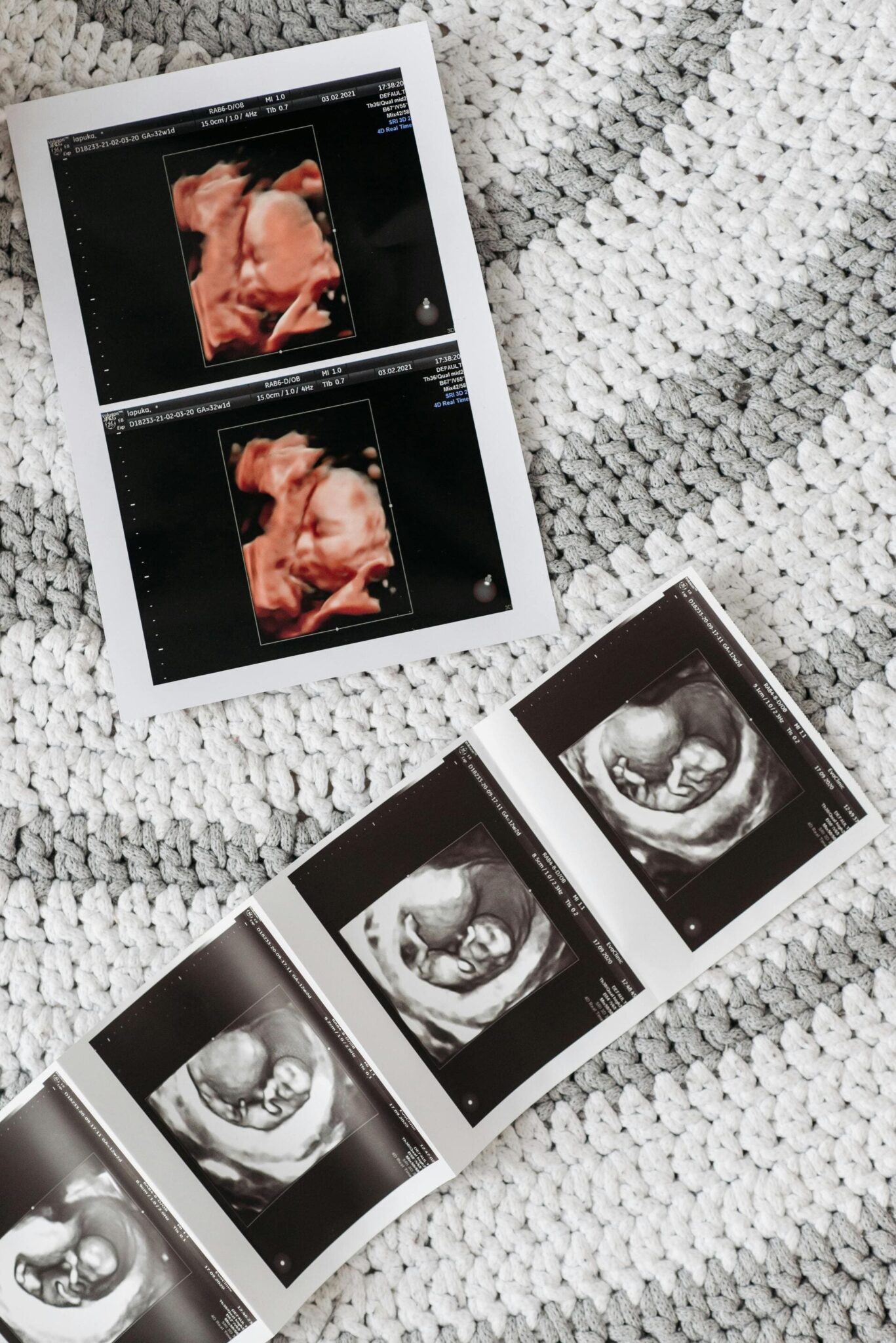 Diferencias entre Ecografías 2D, 3D, 4D y 5D | Preventive Health