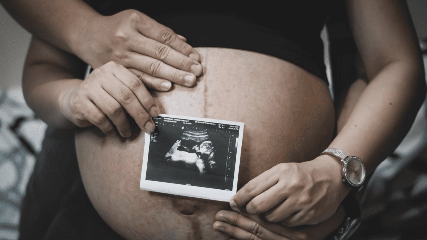 Estrés Prenatal y su Impacto en la Salud Materna y Fetal | Preventive ...